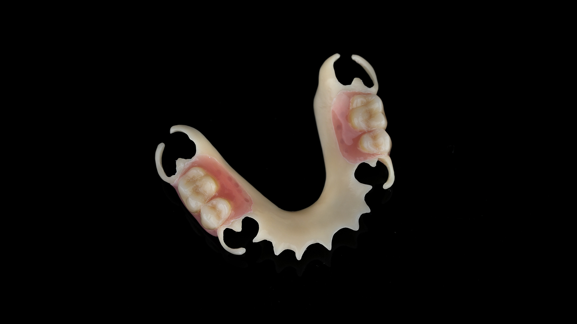 Flexible Dentures | Suplerflex Partial Denture | DentCare Dental Lab